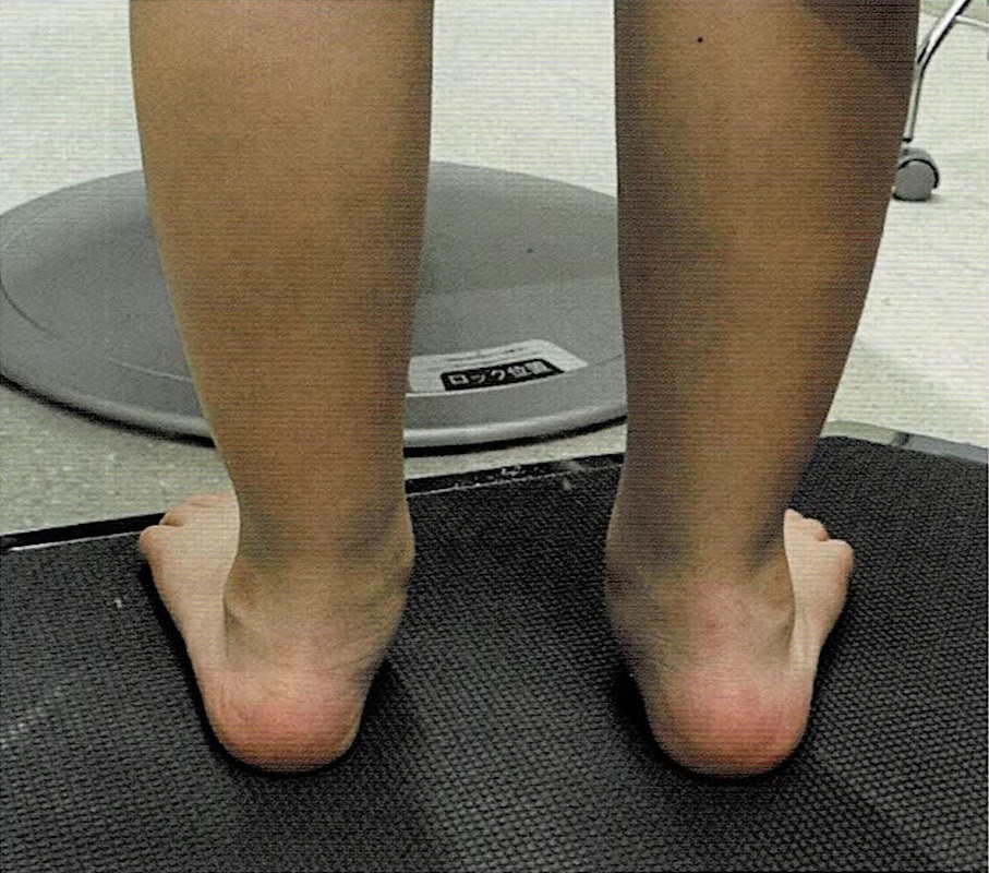 図8 Too many toe sign
