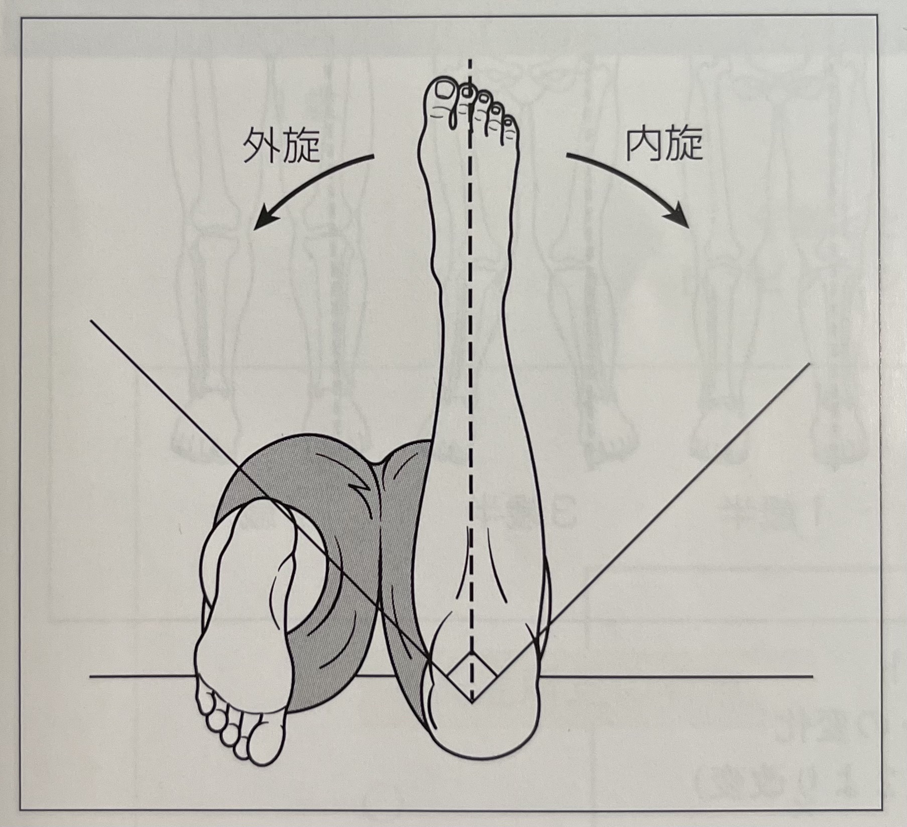 ※左の図から足部の評価(Heel bisector line)、下腿の評価(Thigh foot angle)、大腿骨前捻の評価